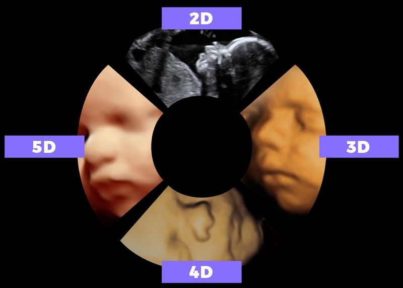 Sự khác nhau giữa siêu âm 2d, 3d, 4d, 5d và ứng dụng của từng kỹ thuật