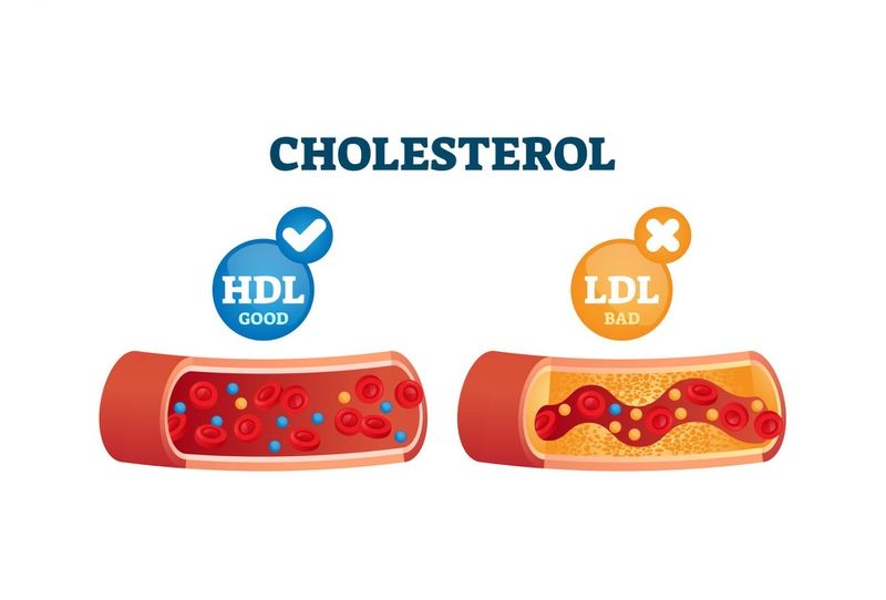 Ldl cholesterol: tìm hiểu và tính toán chỉ số ldl cholesterol