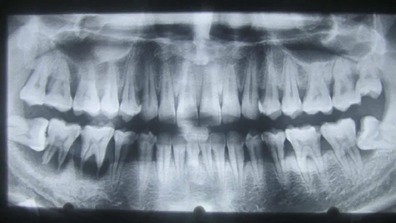 Chụp ct răng - công cụ quan trọng trong nha khoa