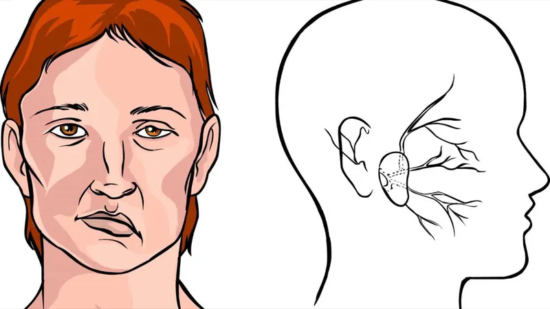 U tuyến nước bọt mang tai: tất cả những điều bạn cần biết