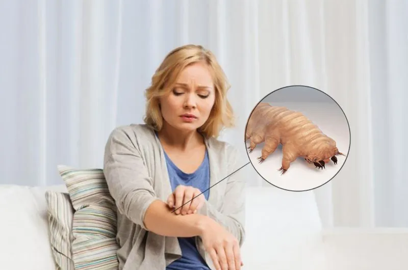 Bệnh viêm da do Demodex là gì? Cách chuẩn đoán và điều trị - Thư viện bệnh