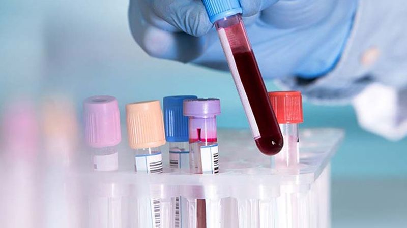 Clo test dương tính: ý nghĩa, nguyên nhân và cách xử lý