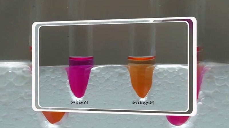 Clo test dương tính: ý nghĩa, nguyên nhân và cách xử lý