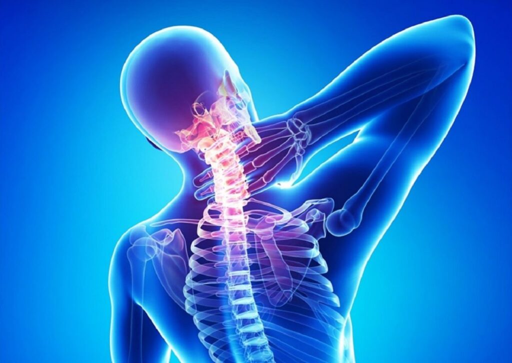 Hiểu và Đối Phó Với Bệnh Thoái Hóa Đốt Sống Cổ: Những Phương Pháp Điều ...