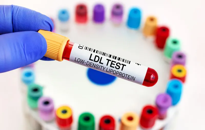 Ldl cholesterol: tìm hiểu và tính toán chỉ số ldl cholesterol